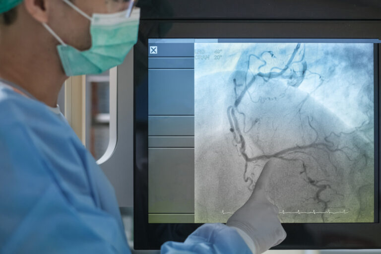 CathEd – Master Angiogram Diagnosis